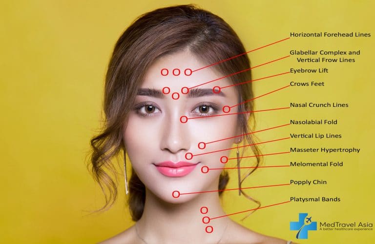 Botox: Cosmetic Uses of Botulinum Toxin - MedTravel Asia
